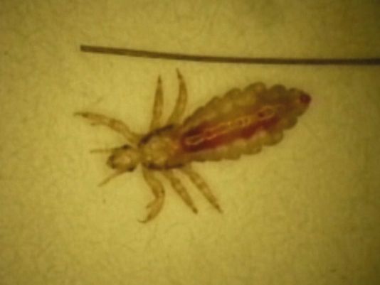 Lice growing more resistant to common treatments | kgw.com